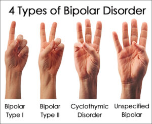 4 Types of Bipolar Disorder, Symptoms and Treatment - Summit Malibu
